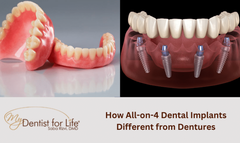How are All-on-4 Dental Implants different from dentures?