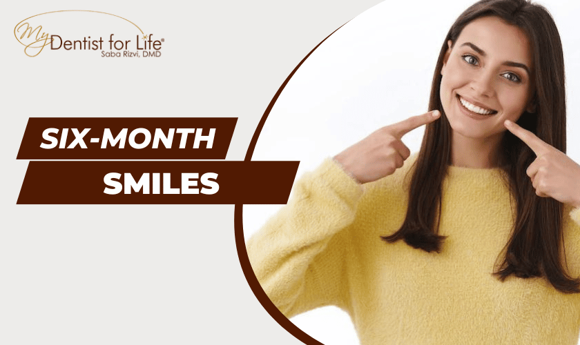 5 Reasons Six-Month Smiles is Best For You?