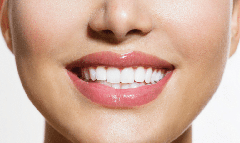 KÖR® Teeth Whitening - Step By Step Process & Duration