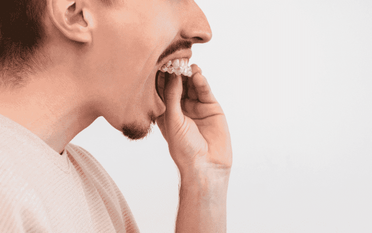 Ways To Remove Of Yellow Stains From Your Invisalign